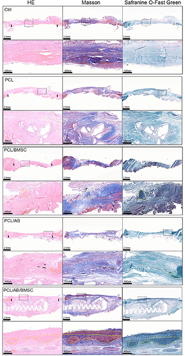 3D bioprinted autologous bone particle scaffolds for cranioplasty ...
