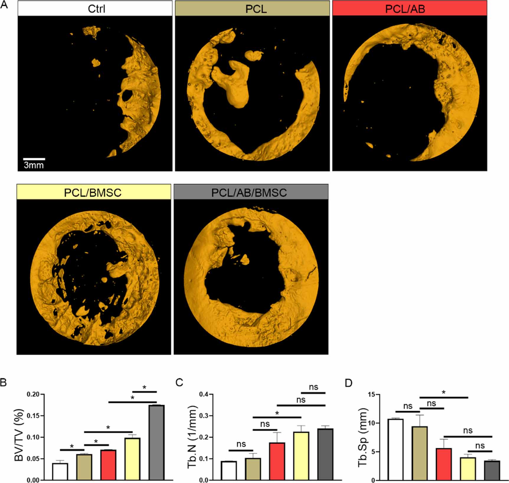 3D bioprinted autologous bone particle scaffolds for cranioplasty ...