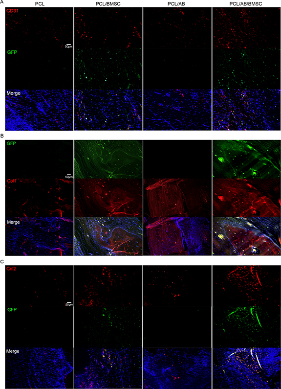 3D bioprinted autologous bone particle scaffolds for cranioplasty ...