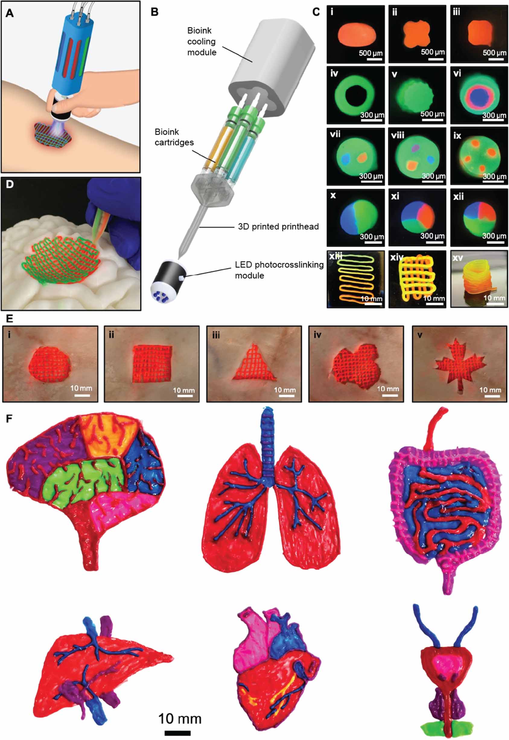 A handheld bioprinter for multi-material printing of complex constructs ...