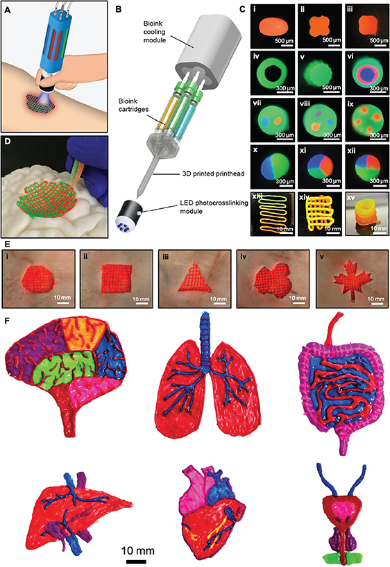 A handheld bioprinter for multi-material printing of complex constructs ...