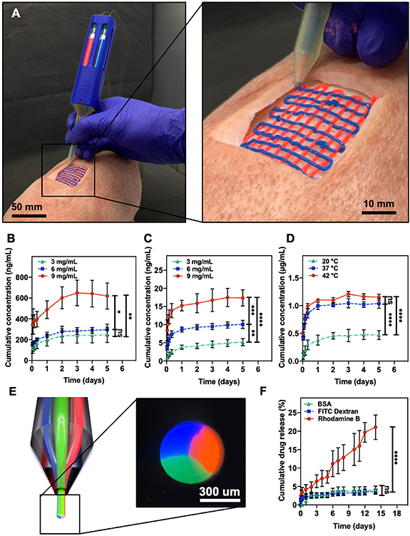 A handheld bioprinter for multi-material printing of complex constructs ...