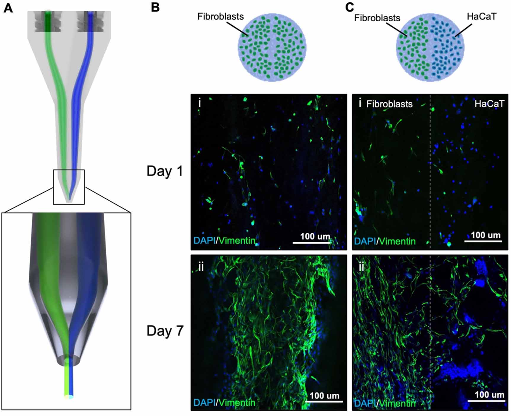 A handheld bioprinter for multi-material printing of complex constructs ...