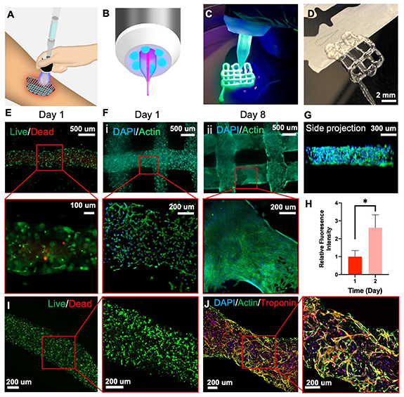A handheld bioprinter for multi-material printing of complex constructs ...