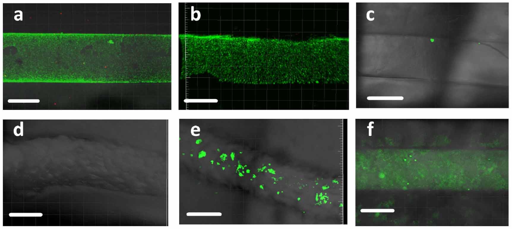 Growing human-scale scala tympani-like in vitro cell constructs ...