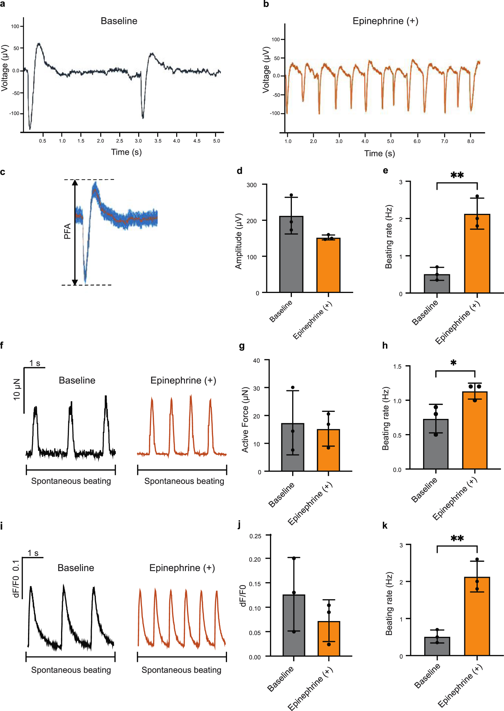 Flexible 3D printed microwires and 3D microelectrodes for heart-on-a ...
