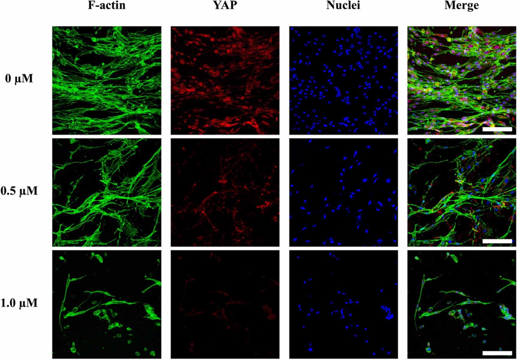 3D-biofabricated chondrocyte-laden decellularized extracellular matrix ...