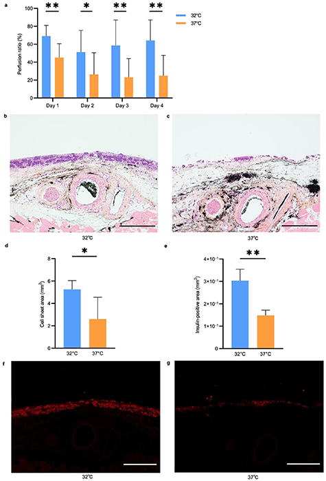 The bioengineering of perfusable endocrine tissue with anastomosable ...