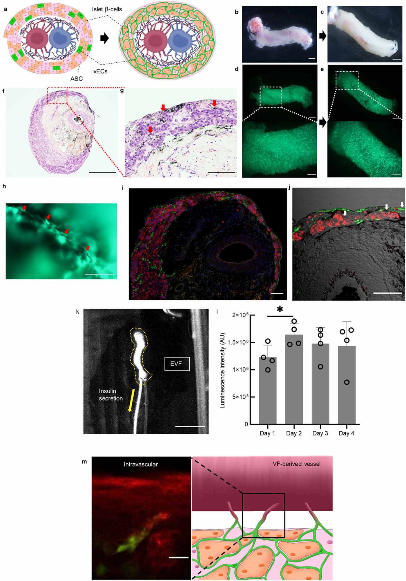 The bioengineering of perfusable endocrine tissue with anastomosable ...