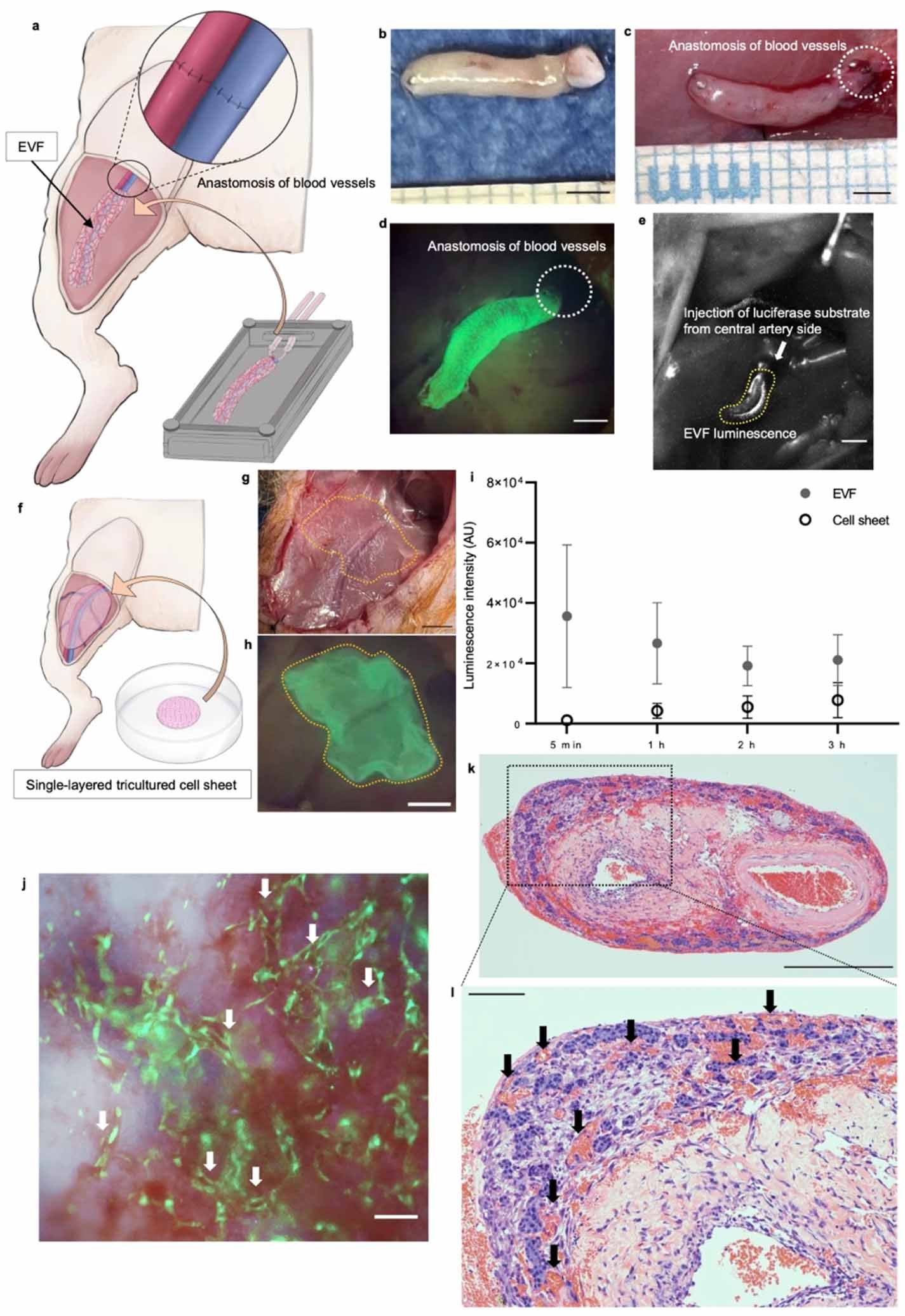 The bioengineering of perfusable endocrine tissue with anastomosable ...