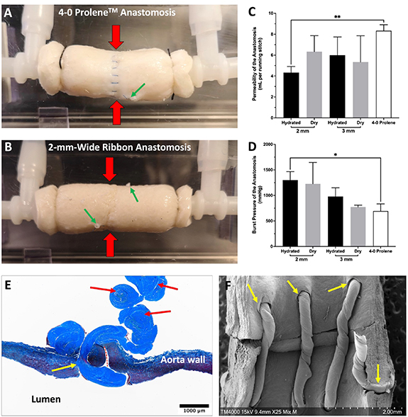 Development and characterization of biological sutures made of cell ...