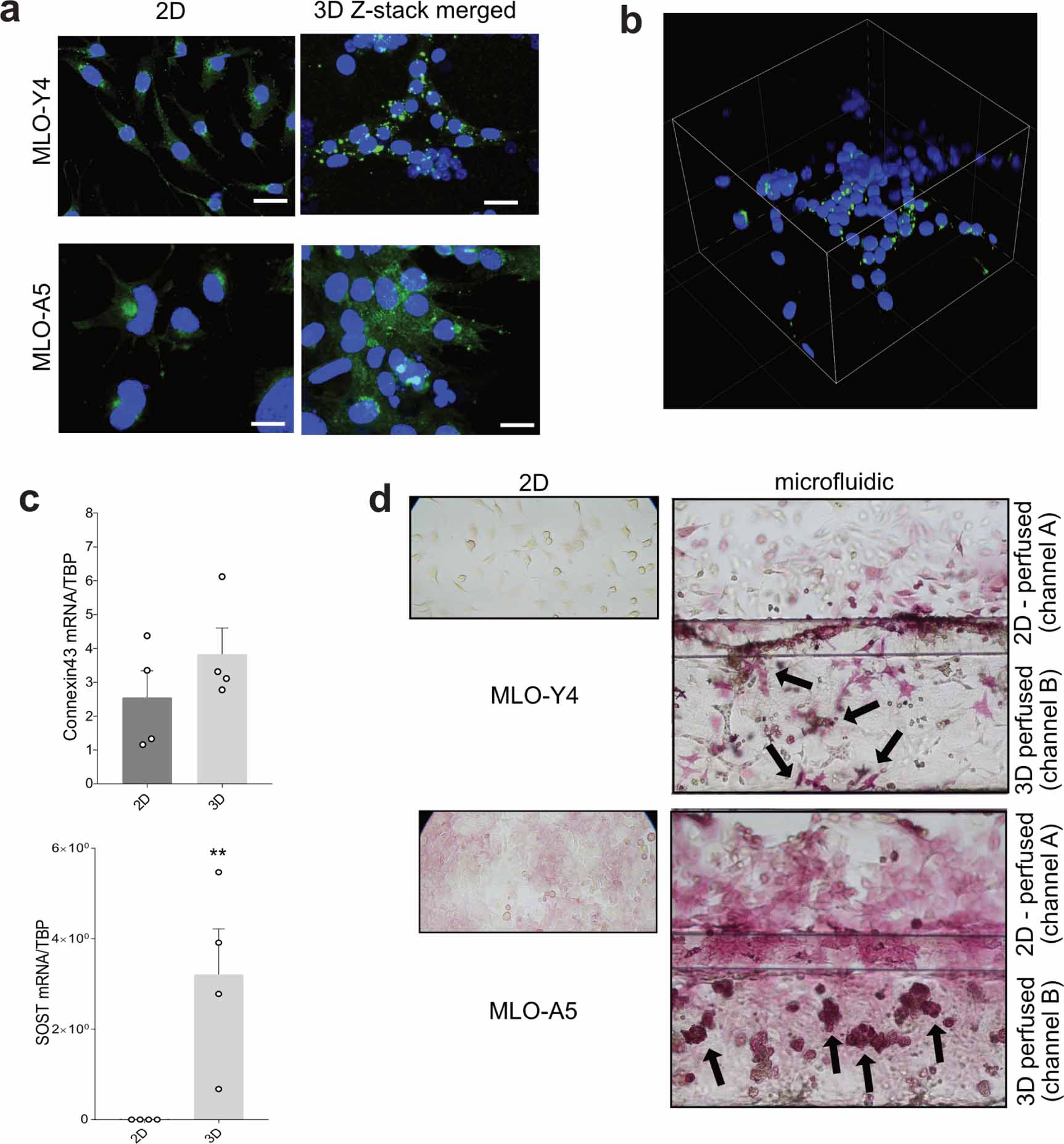 Bone on-a-chip: a 3D dendritic network in a screening platform for ...
