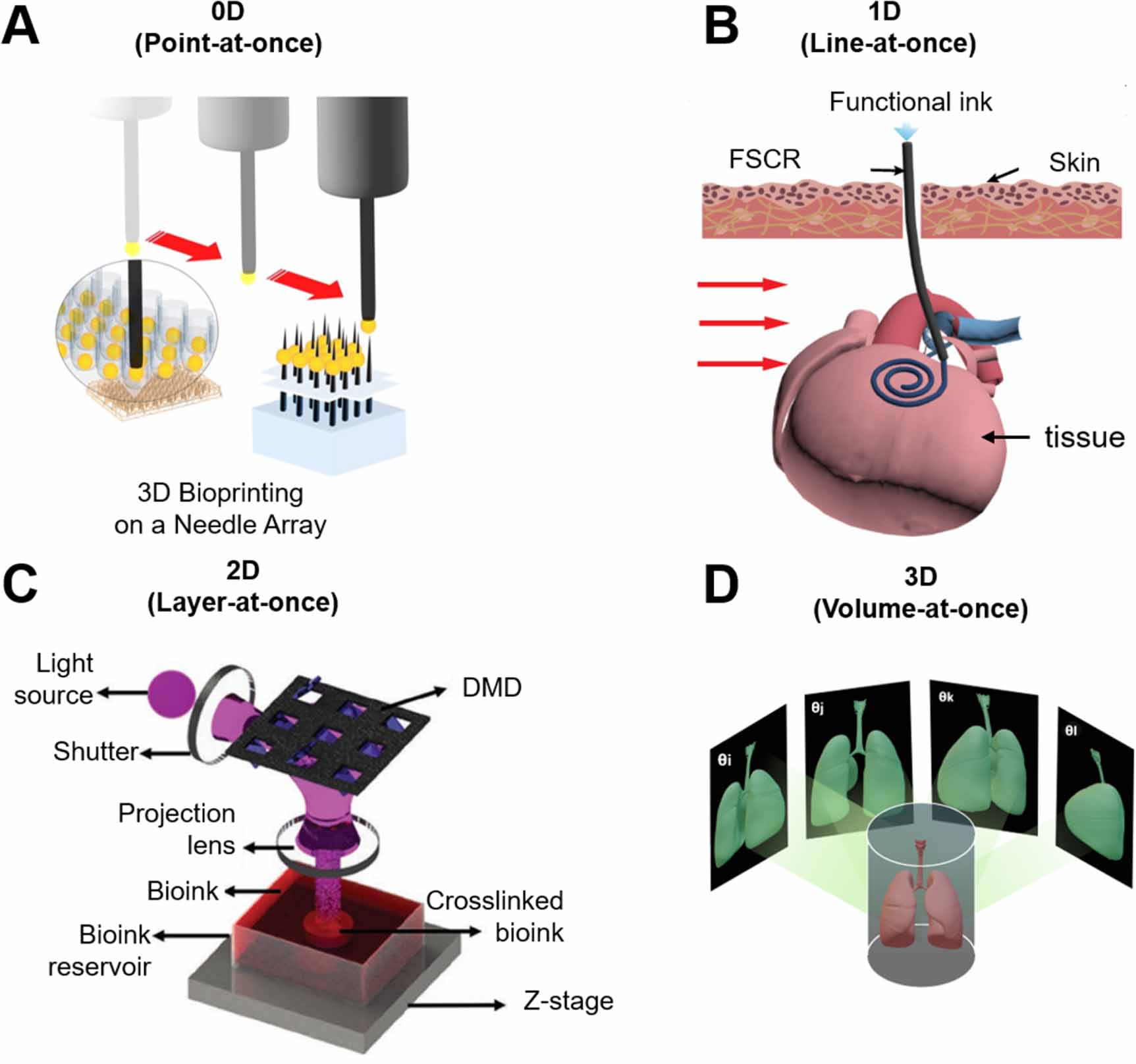 Advances in volumetric bioprinting - IOPscience