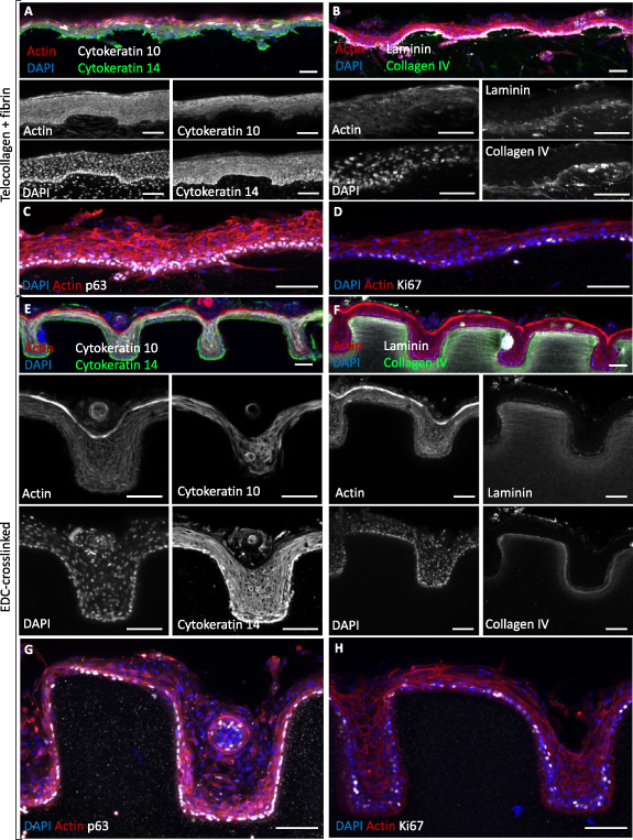 Biomimetic human skin model patterned with rete ridges - IOPscience