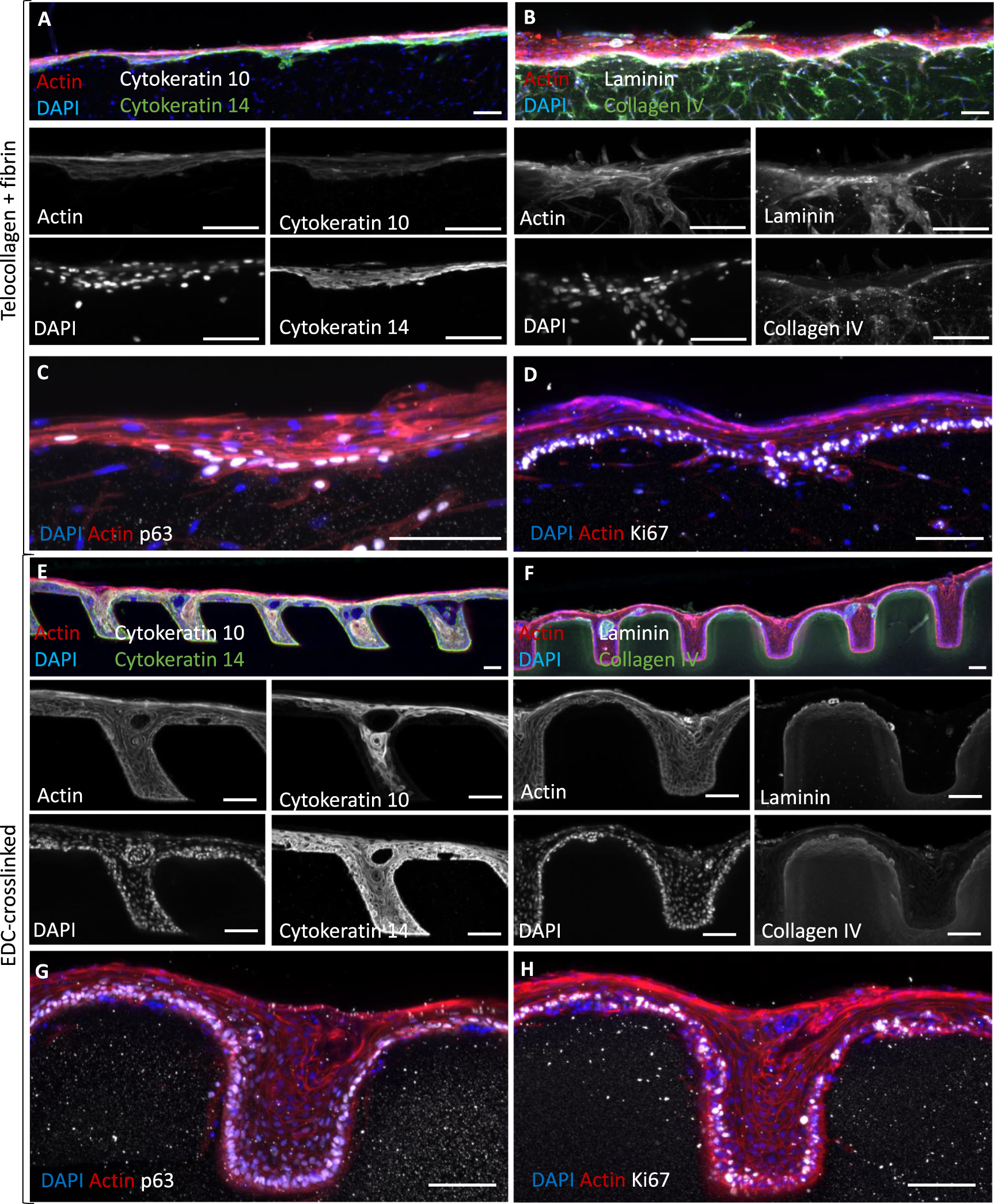 Biomimetic human skin model patterned with rete ridges - IOPscience