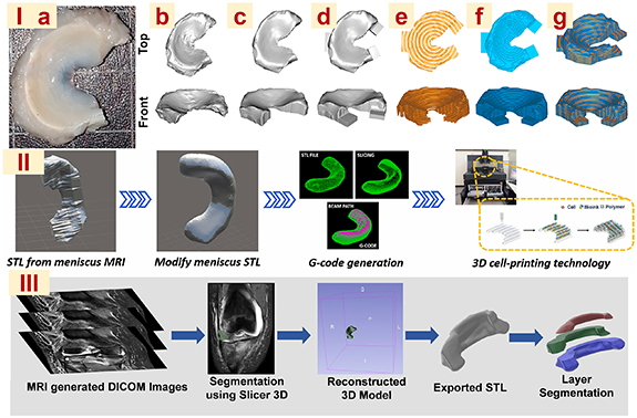 Current advances in engineering meniscal tissues: insights into 3D ...