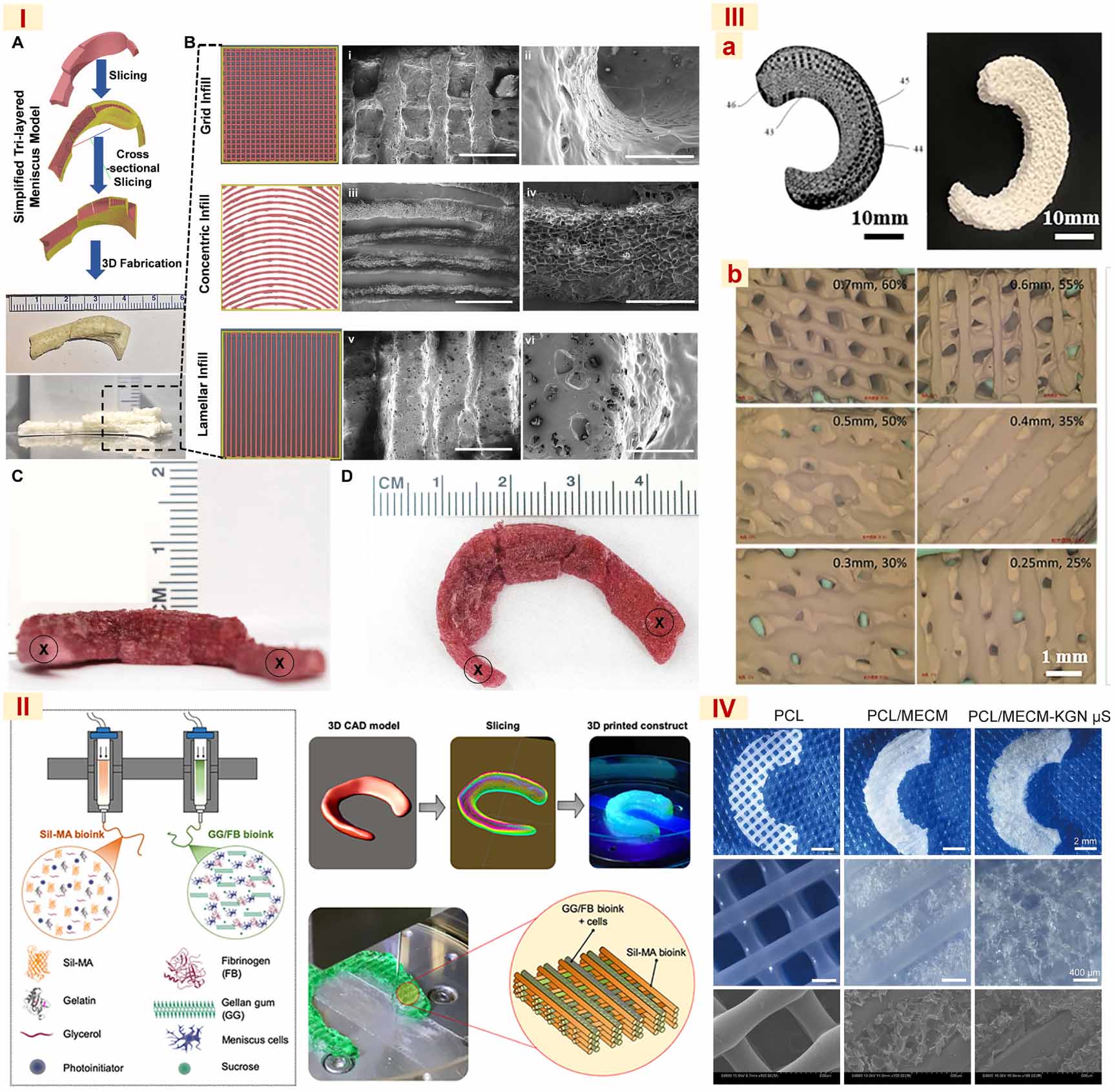 Current advances in engineering meniscal tissues: insights into 3D ...