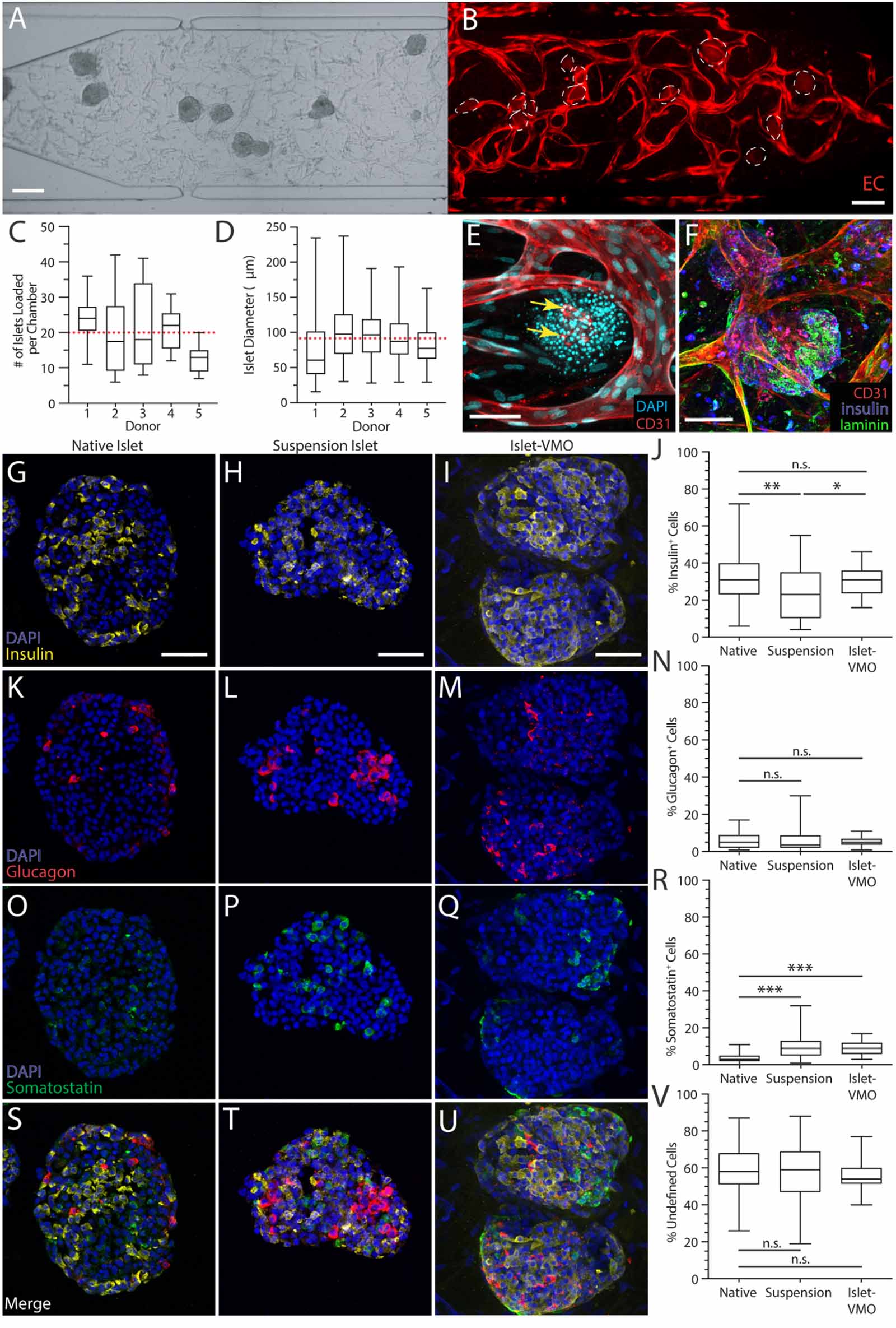 A vascularized 3D model of the human pancreatic islet for ex vivo study ...