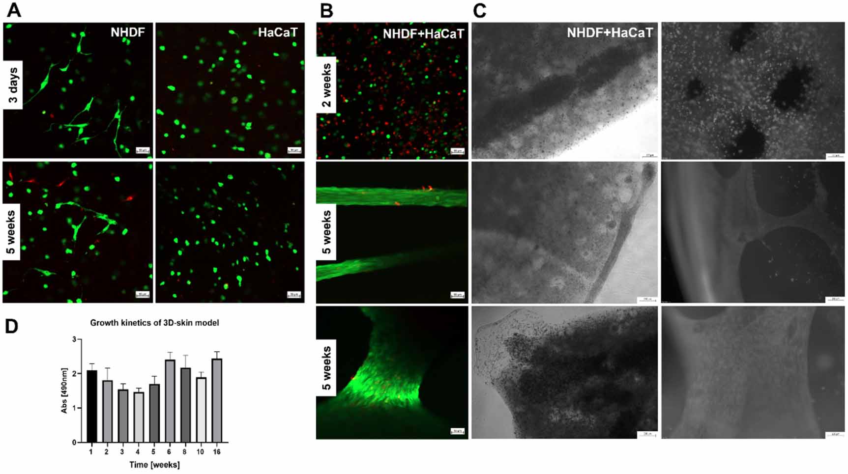 3D modeling of normal skin and cutaneous squamous cell carcinoma. A ...