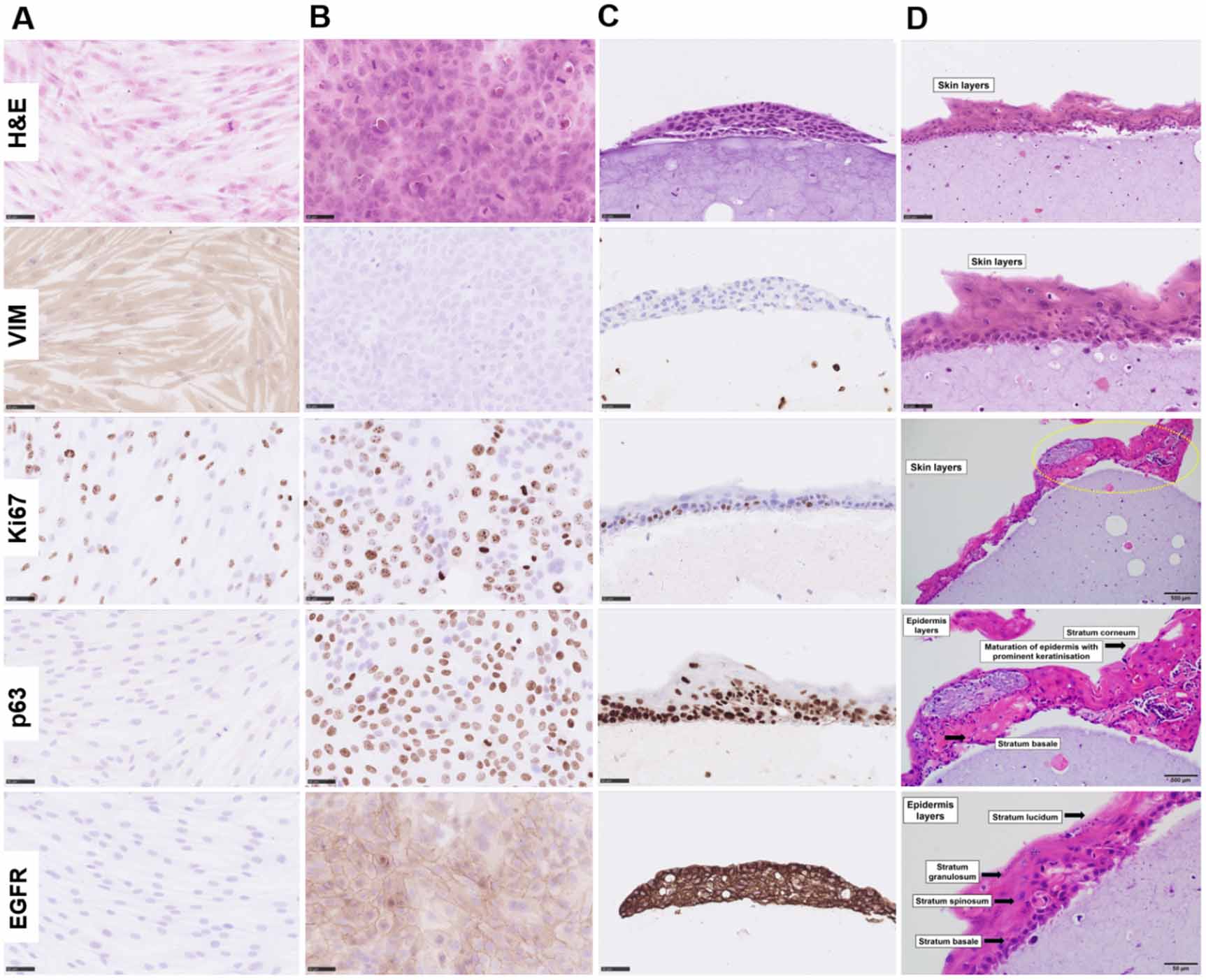 3D modeling of normal skin and cutaneous squamous cell carcinoma. A ...