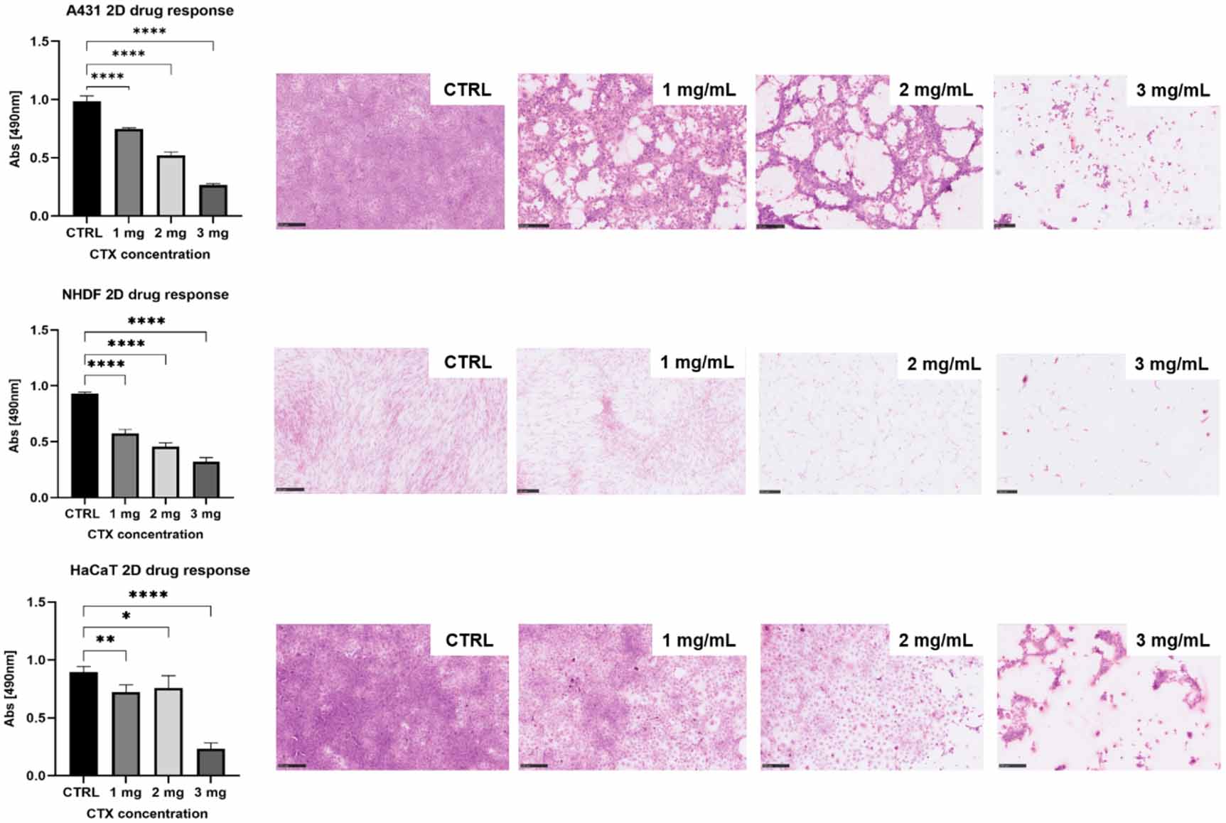 3D modeling of normal skin and cutaneous squamous cell carcinoma. A ...