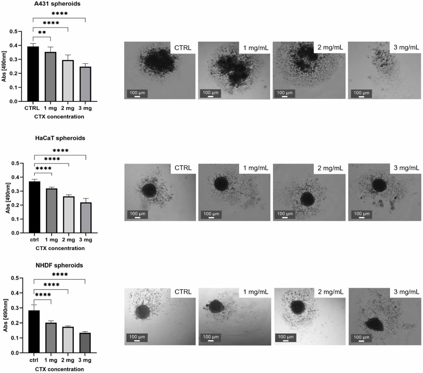 3D modeling of normal skin and cutaneous squamous cell carcinoma. A ...