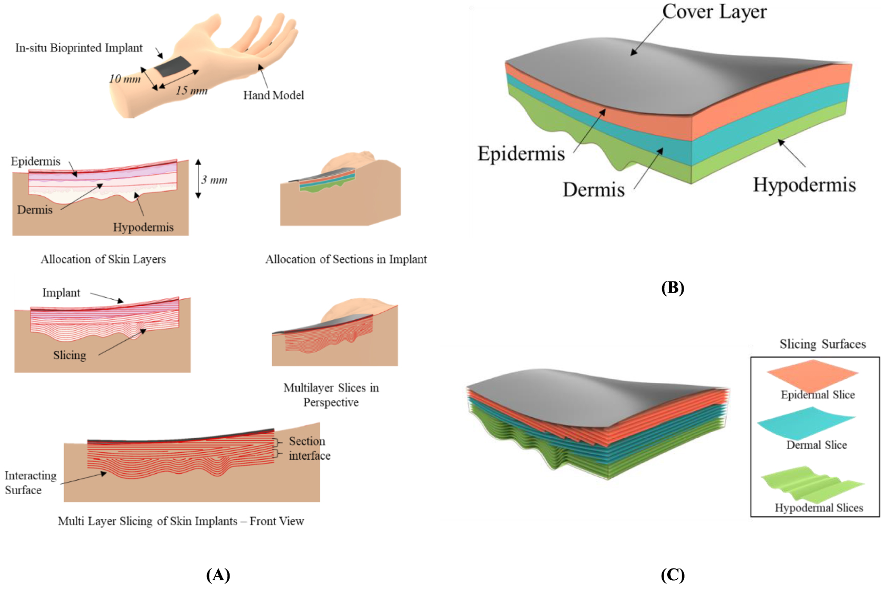 Surface slicing and toolpath planning for in-situ bioprinting of skin ...