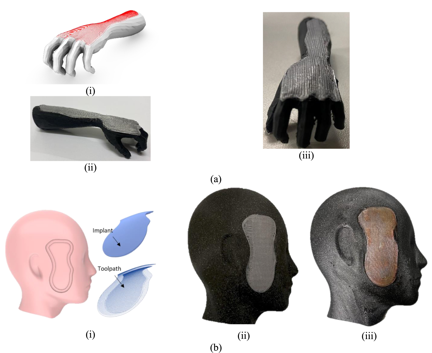 Surface slicing and toolpath planning for in-situ bioprinting of skin ...