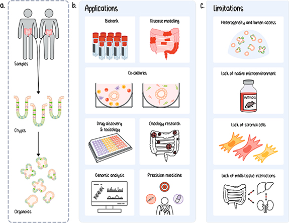 Organoid models: the future companions of personalized drug development ...