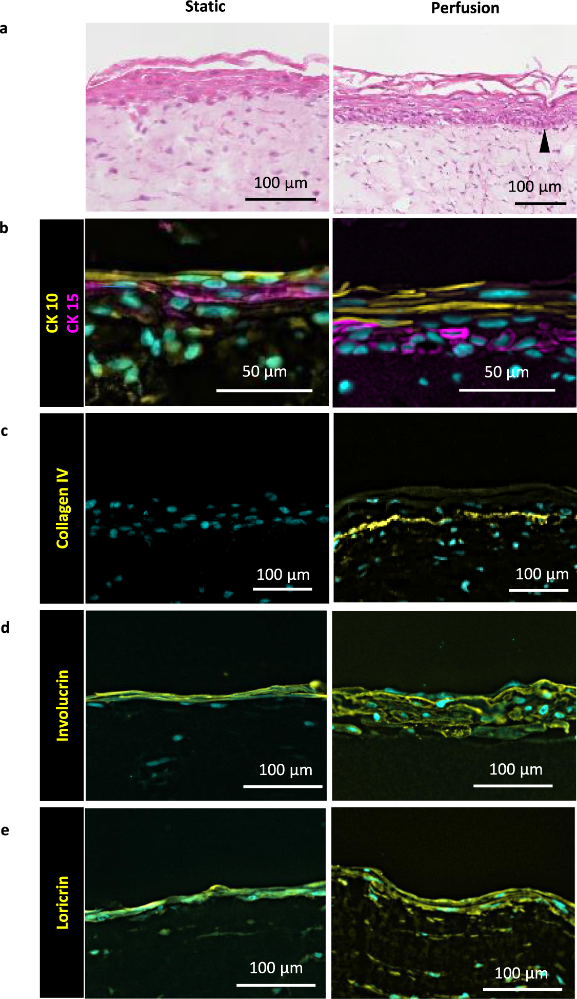 Culture insert device with perfusable microchannels enhances in vitro ...