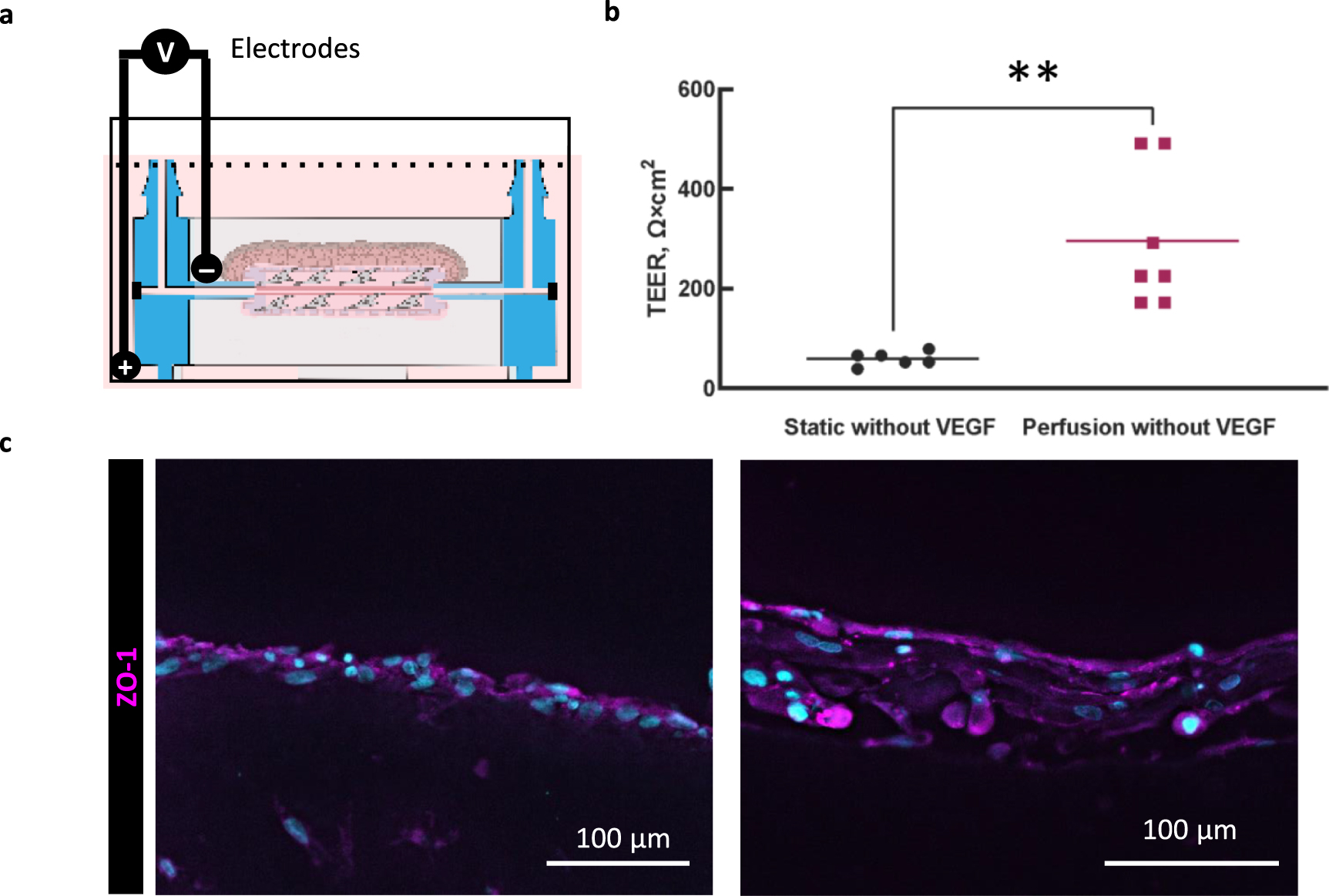 Culture insert device with perfusable microchannels enhances in vitro ...