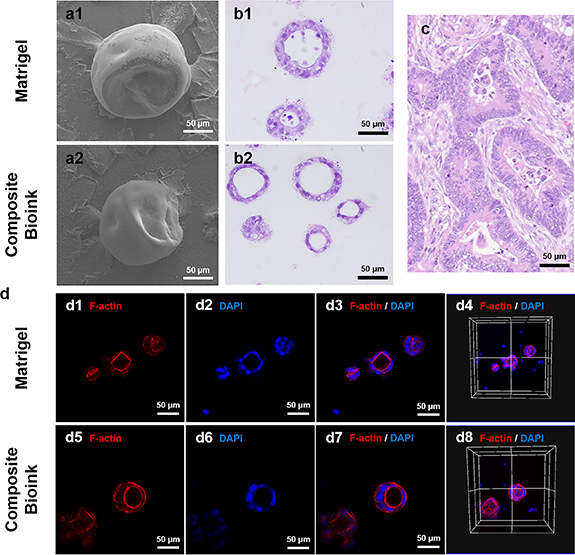 3D bioprinting platform development for high-throughput cancer organoid ...