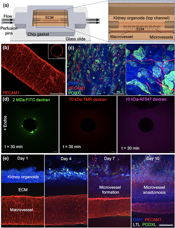 A perfusable, vascularized kidney organoid-on-chip model - IOPscience