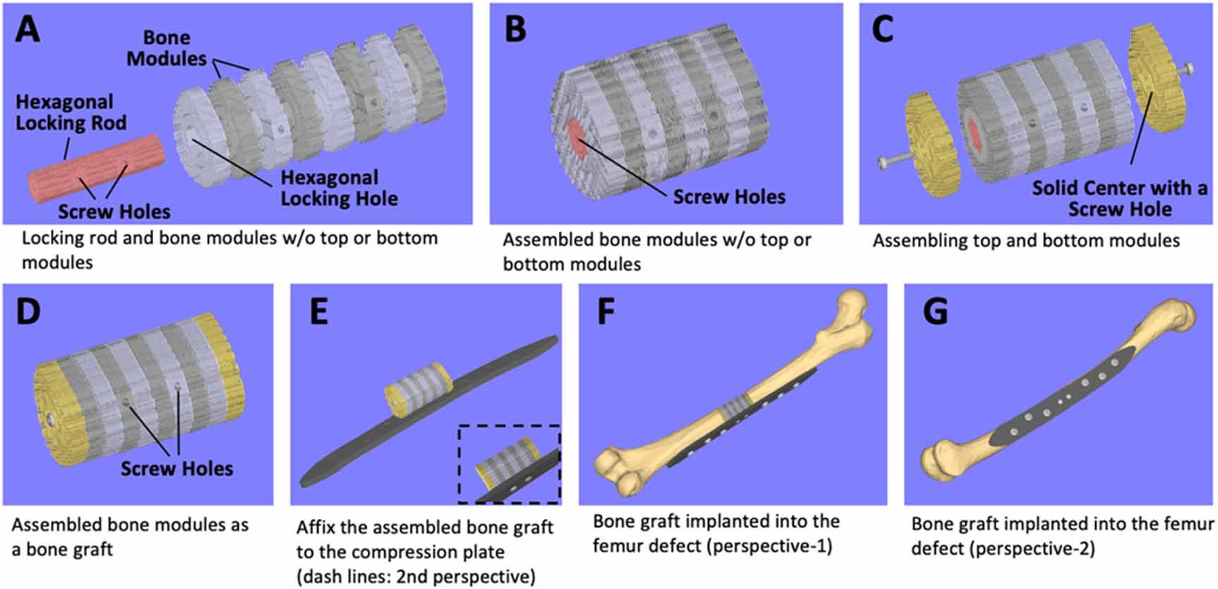 Fabricating vascularized, anatomically accurate bone grafts using 3D ...