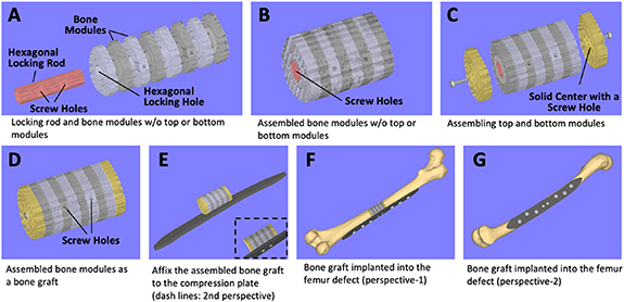 Fabricating vascularized, anatomically accurate bone grafts using 3D ...