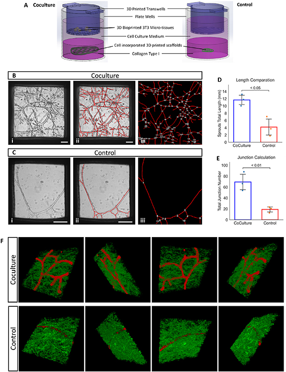 Fabricating vascularized, anatomically accurate bone grafts using 3D ...