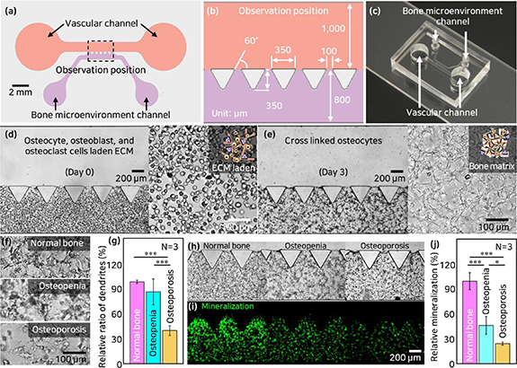 Bone-on-a-chip simulating bone metastasis in osteoporosis - IOPscience