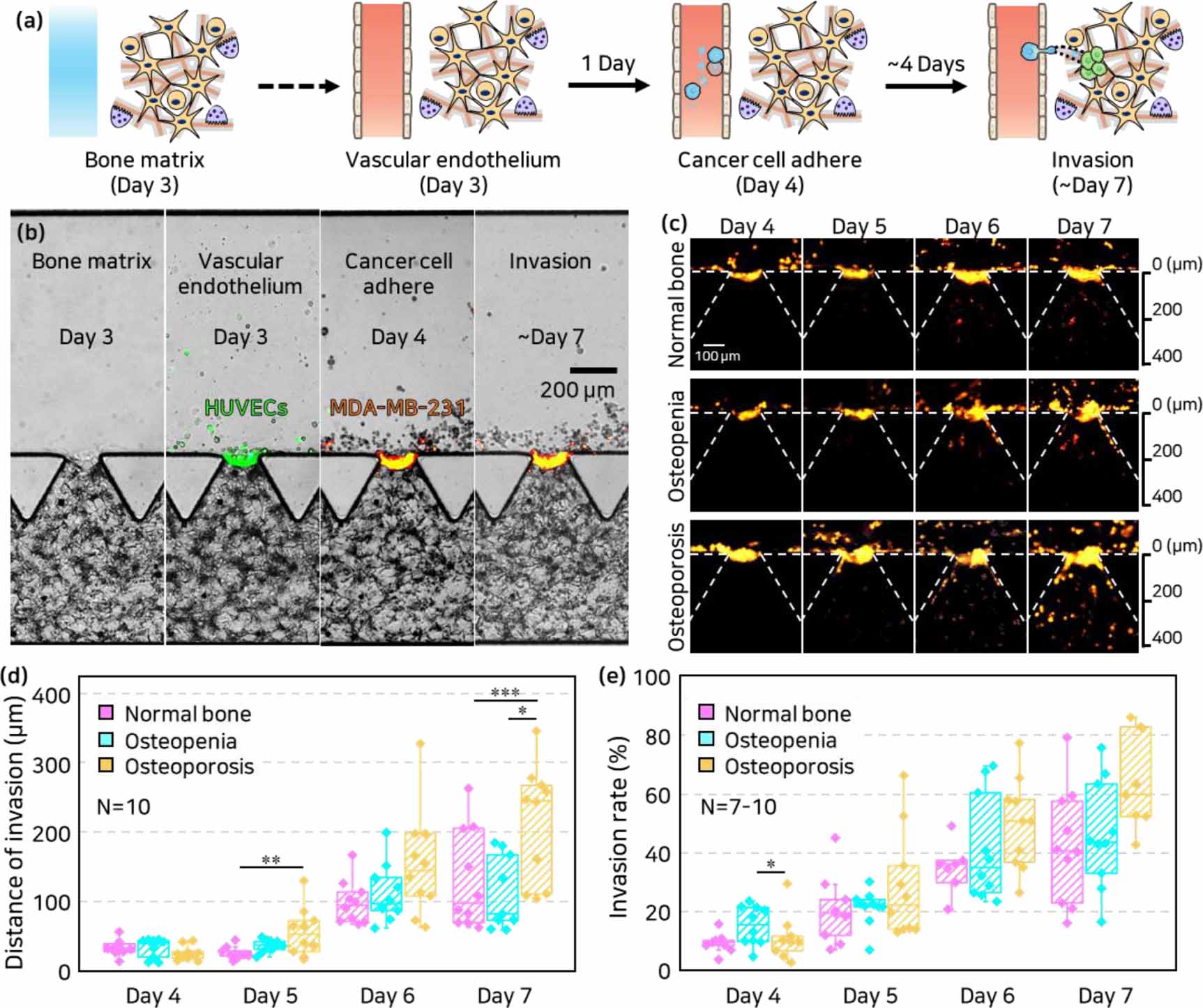 Bone-on-a-chip simulating bone metastasis in osteoporosis - IOPscience