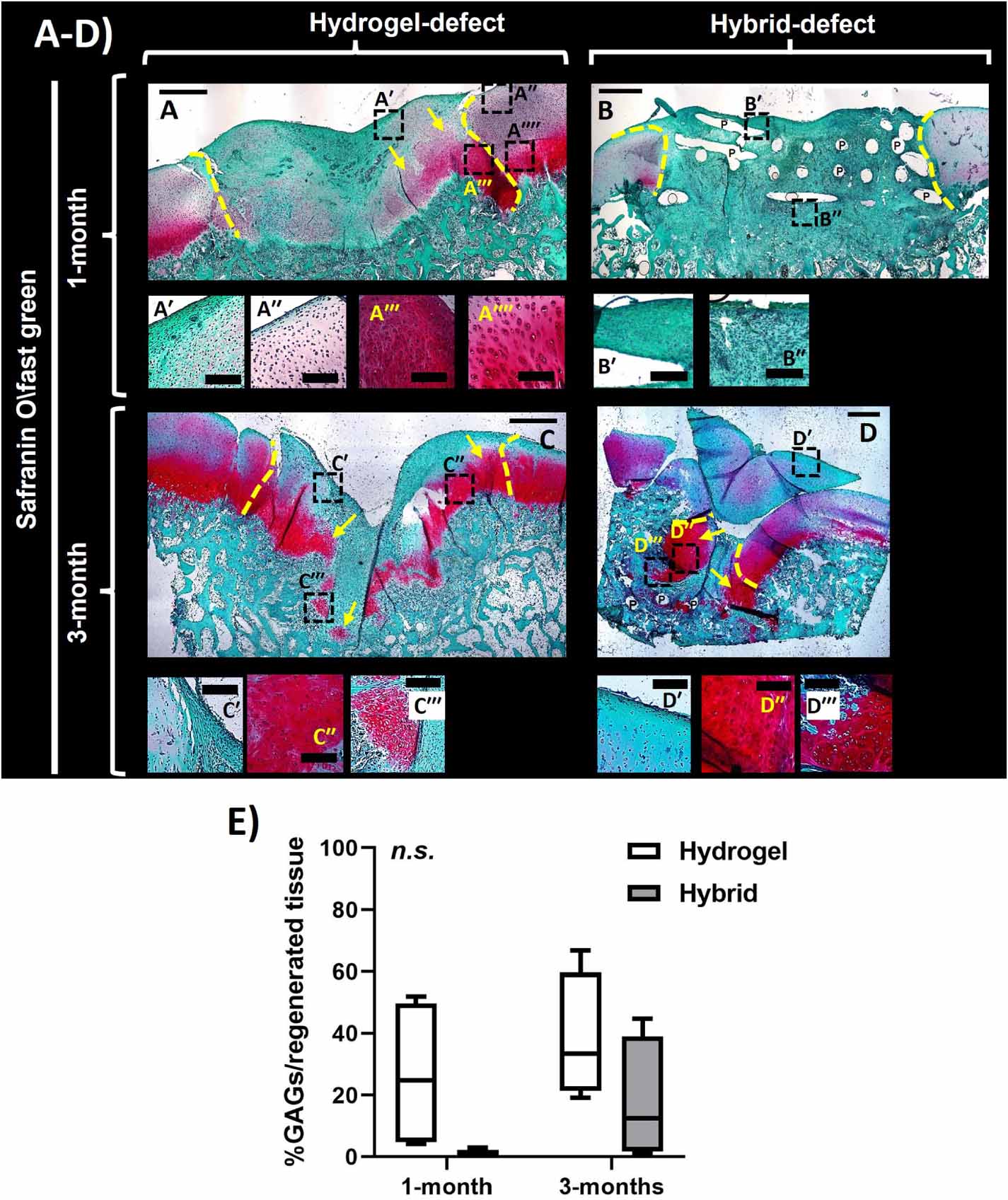 Comparison study on hyaline cartilage versus fibrocartilage formation ...