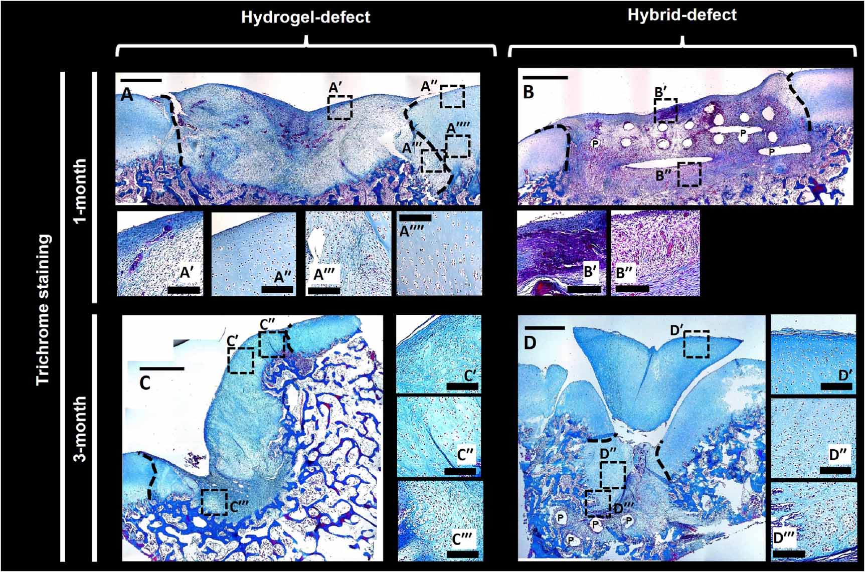 Comparison study on hyaline cartilage versus fibrocartilage formation ...