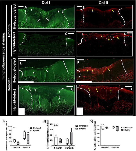 Comparison study on hyaline cartilage versus fibrocartilage formation ...