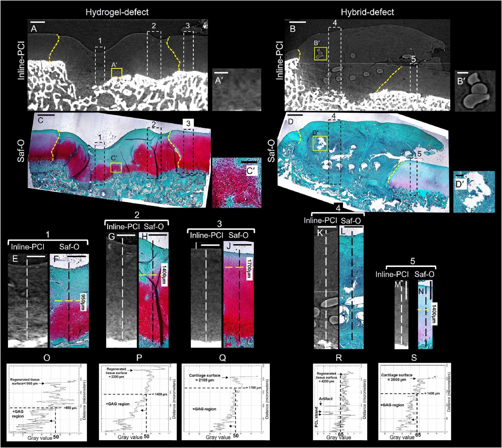 Comparison study on hyaline cartilage versus fibrocartilage formation ...