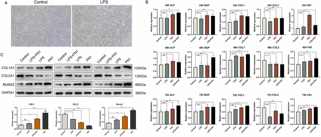 3D printed PGCL@PLA/10CSPL composite scaffolds loaded with fibronectin ...