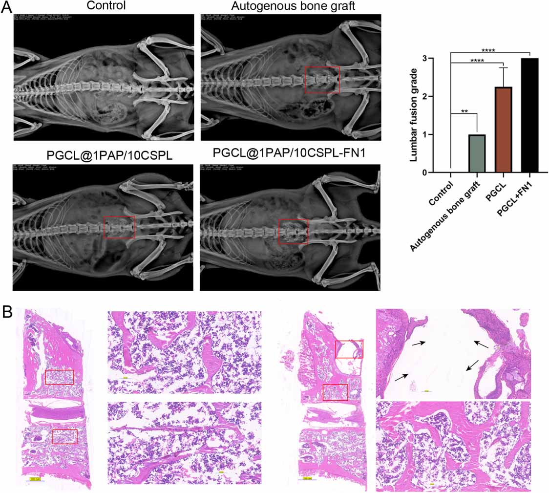 3D printed PGCL@PLA/10CSPL composite scaffolds loaded with fibronectin ...