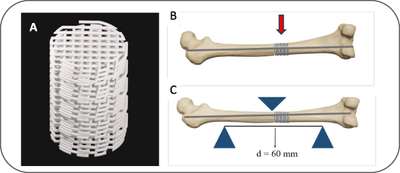 3D printed PCL-nHAp composite implants for the treatment of segmental ...