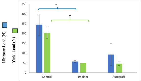 3D printed PCL-nHAp composite implants for the treatment of segmental ...