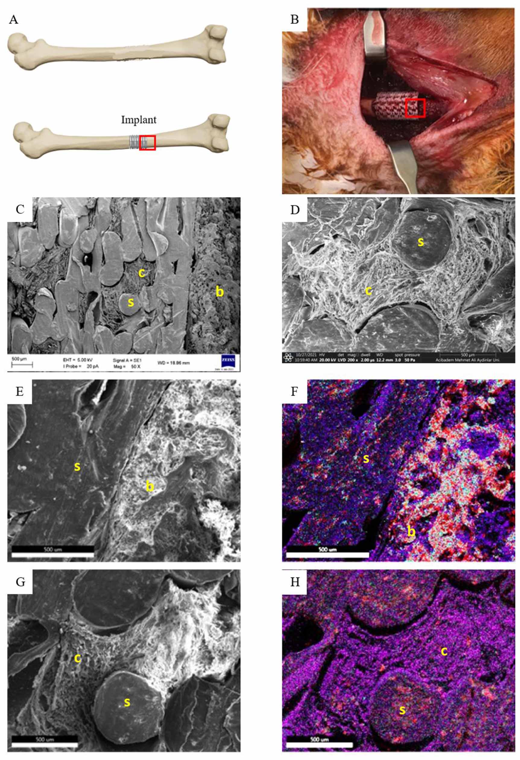 3D printed PCL-nHAp composite implants for the treatment of segmental ...