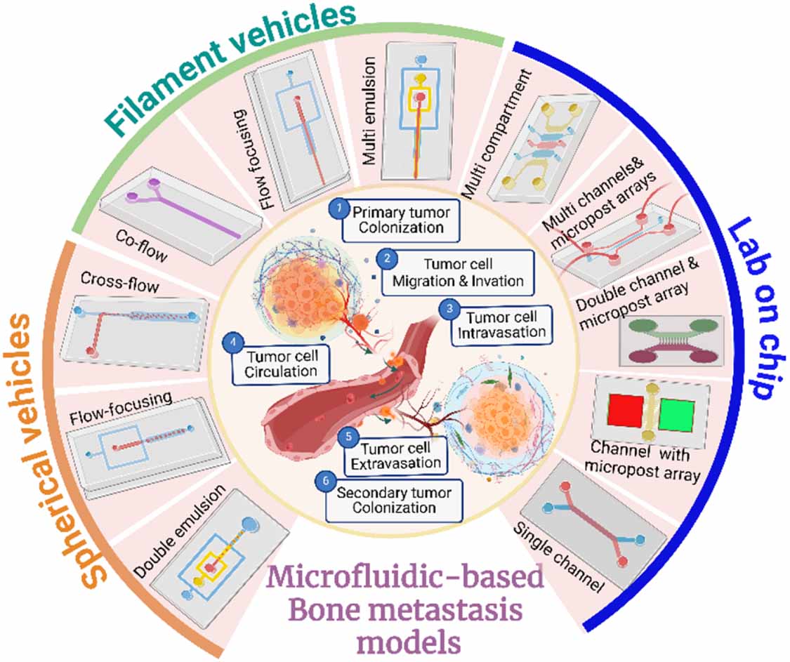 Advances in microfluidic biofabrication technology for bone metastasis ...