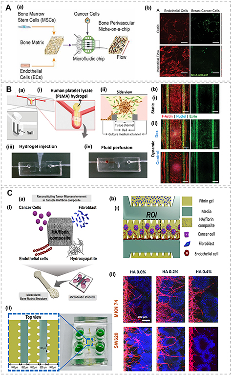 Advances in microfluidic biofabrication technology for bone metastasis ...