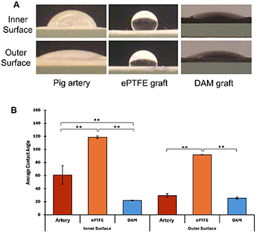 Biofabrication of small-diameter vascular graft with acellular human ...